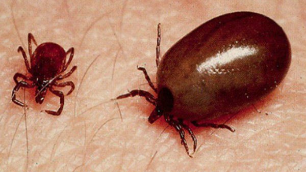 Scrub Typhus; Know About The Cause, Symptoms And Prevention Of The ...