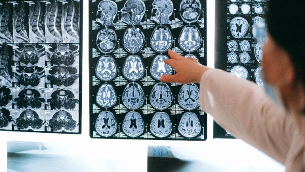 50 Years Ago, The First CT Scan Let Doctors See Inside A Living Skull ...