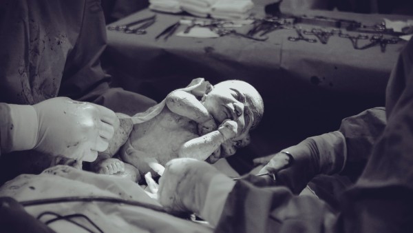 Person Born With Caul