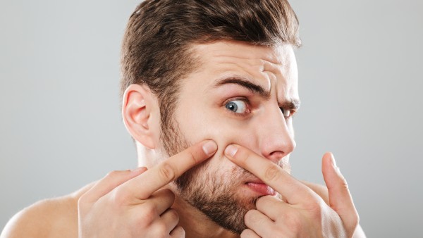 How To Treat Painful Pimples At Home? Beauty Tips For Everyone ...