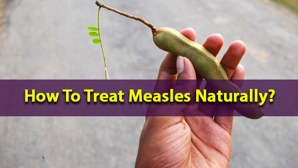 Measles Immunisation Day 2022: How To Treat Measles Naturally ...