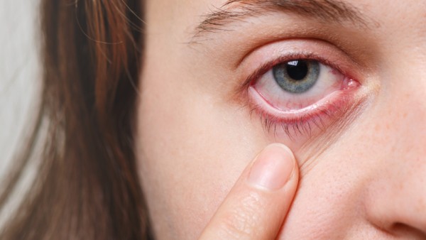 Mucus Strings In Eyes