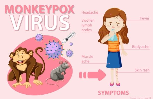 Govt Releases Monkeypox Guidelines On Detecting And Treating The ...