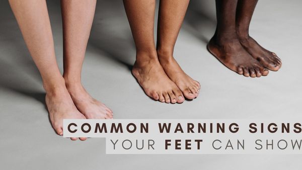 Common Warning Signs Your Feet Can Show About Your Health - Boldsky.com