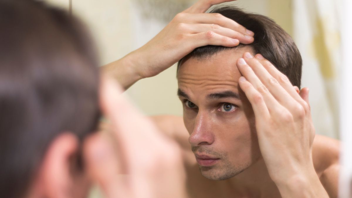 Haircare: Tips For Balding Men - Boldsky.com