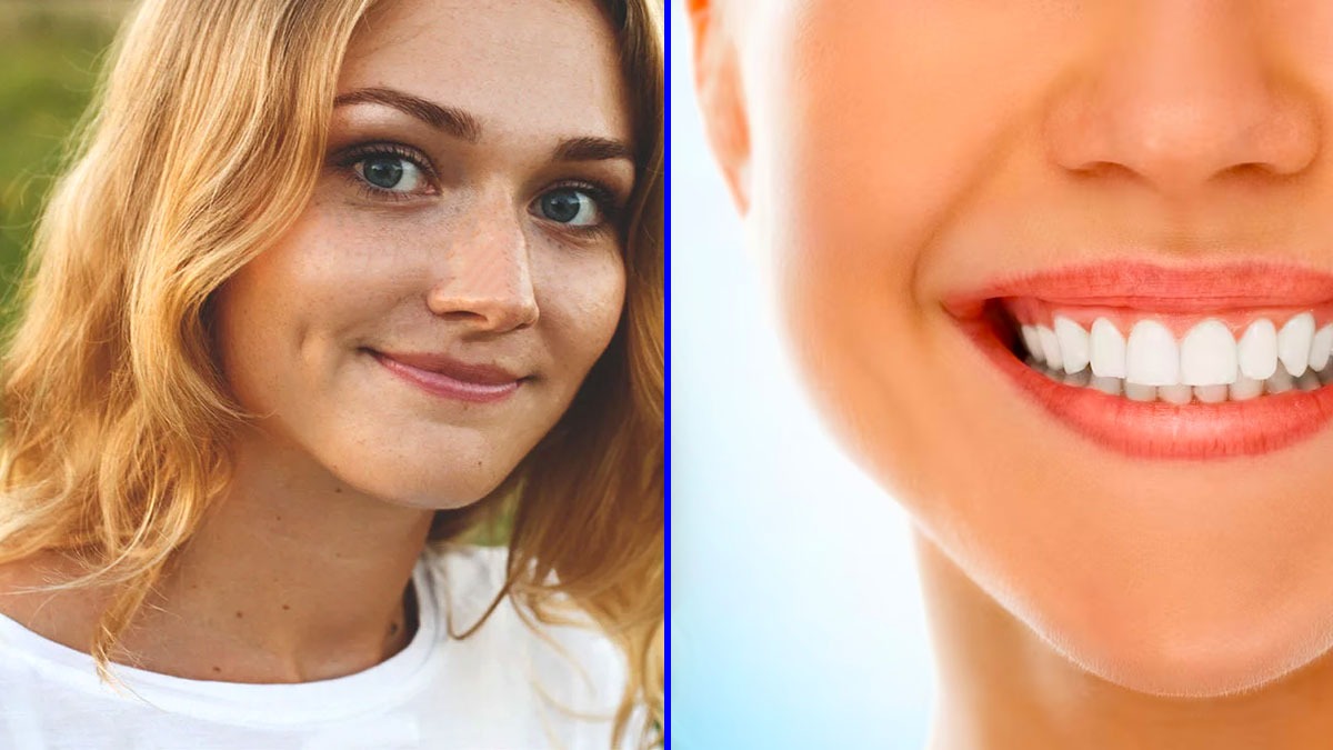 Your Teeth Can Present A Clue About Your Life And Personality. Know ...