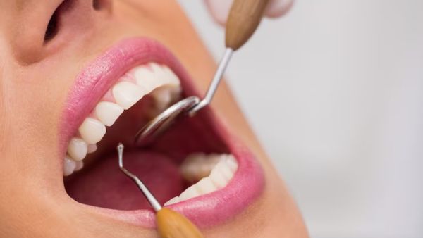 How To Clean Tooth Cavities At Home? Is It Safe? - Boldsky.com