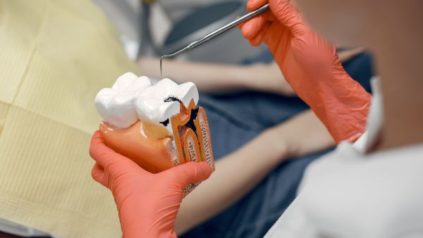 How To Clean Tooth Cavities At Home? Is It Safe? - Boldsky.com