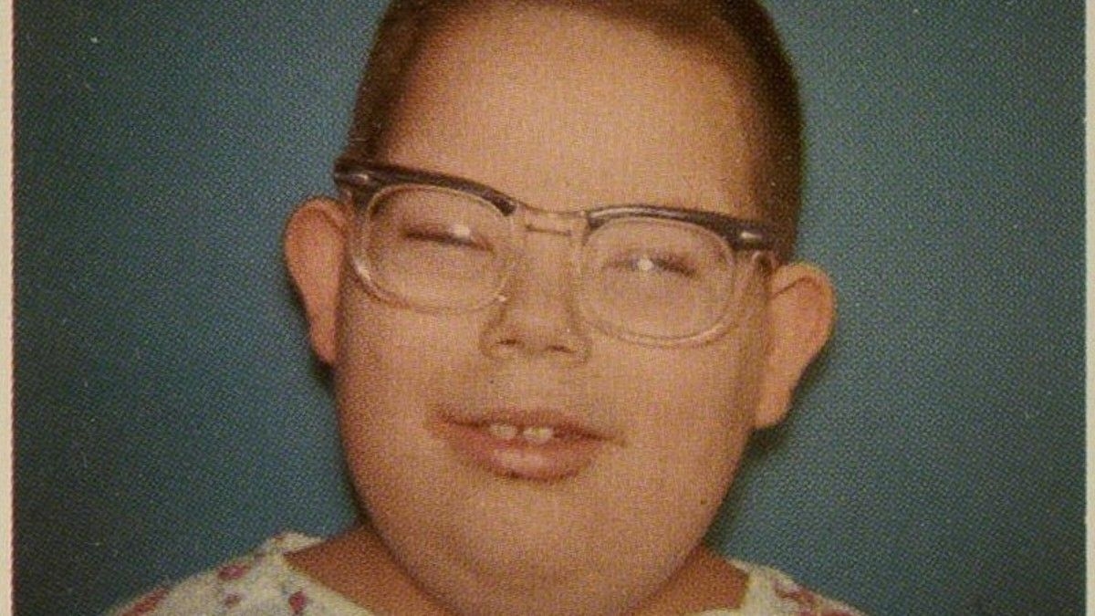 Laurence-Moon Syndrome (LMS) - Rare Genetic Disorder | Symptoms ...