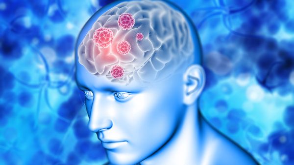 Understanding Neurocysticercosis: Parasitic Infections Leading to ...