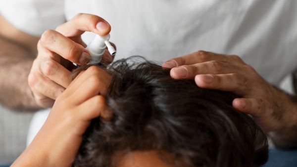 Myths vs Facts: Lice Only Grow On Clean Hair - Boldsky.com
