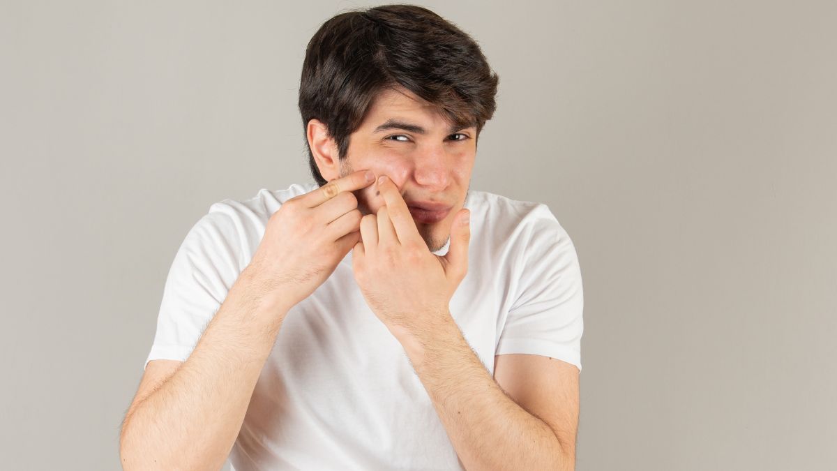 5 Quick And Easy Ways To Deal With Pimple Full Of Pus - Boldsky.com