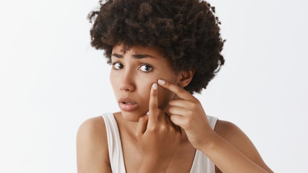 5 Quick And Easy Ways To Deal With Pimple Full Of Pus - Boldsky.com