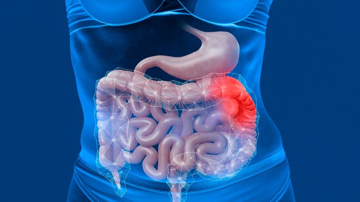 Detecting Bowel Cancer: 10 Signs Of This Silent Killer To Watch Out For ...