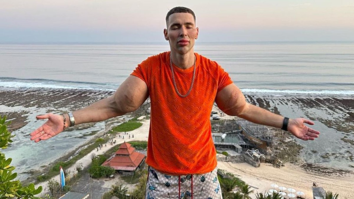 Russian Man Nicknamed 'Popeye' Injecting Vaseline Into Muscles Is A ...